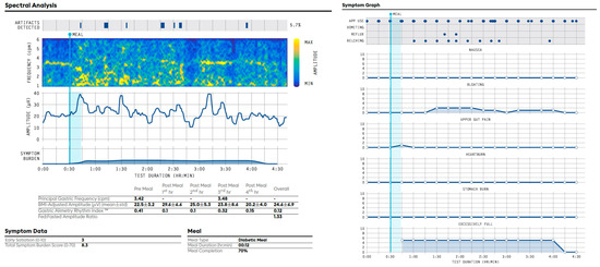 Gastric Alimetry® Test Interpretation in Gastroduodenal Disorders ...
