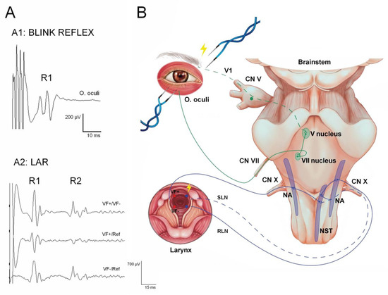 The Role of Neurophysiology in Managing Patients with Chiari Malformations