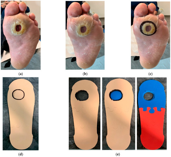 JCM | Free Full-Text | Patients’ Buying Behavior for Non-Reimbursed Off ...