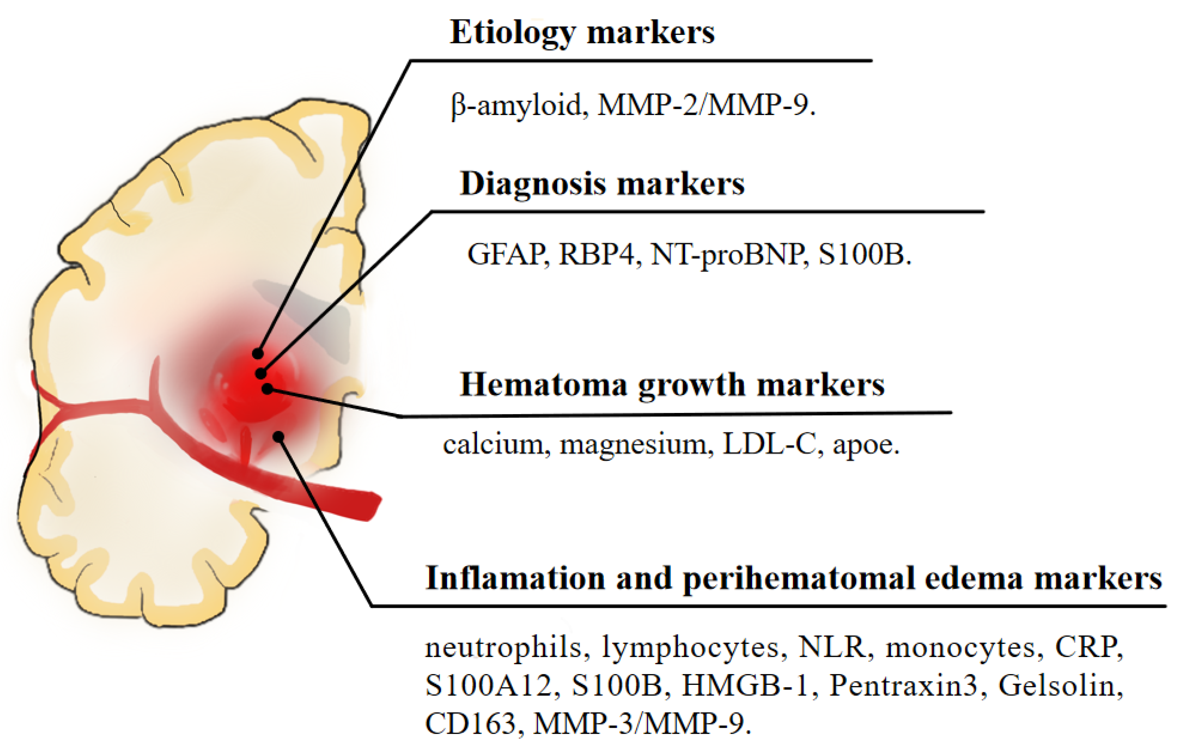 Blood-Based Biomarkers in Intracerebral Hemorrhage