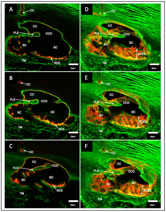 Trabecular Meshwork Movement Controls Distal Valves and Chambers: New ...