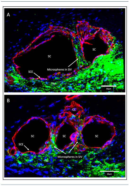 Trabecular Meshwork Movement Controls Distal Valves and Chambers: New ...