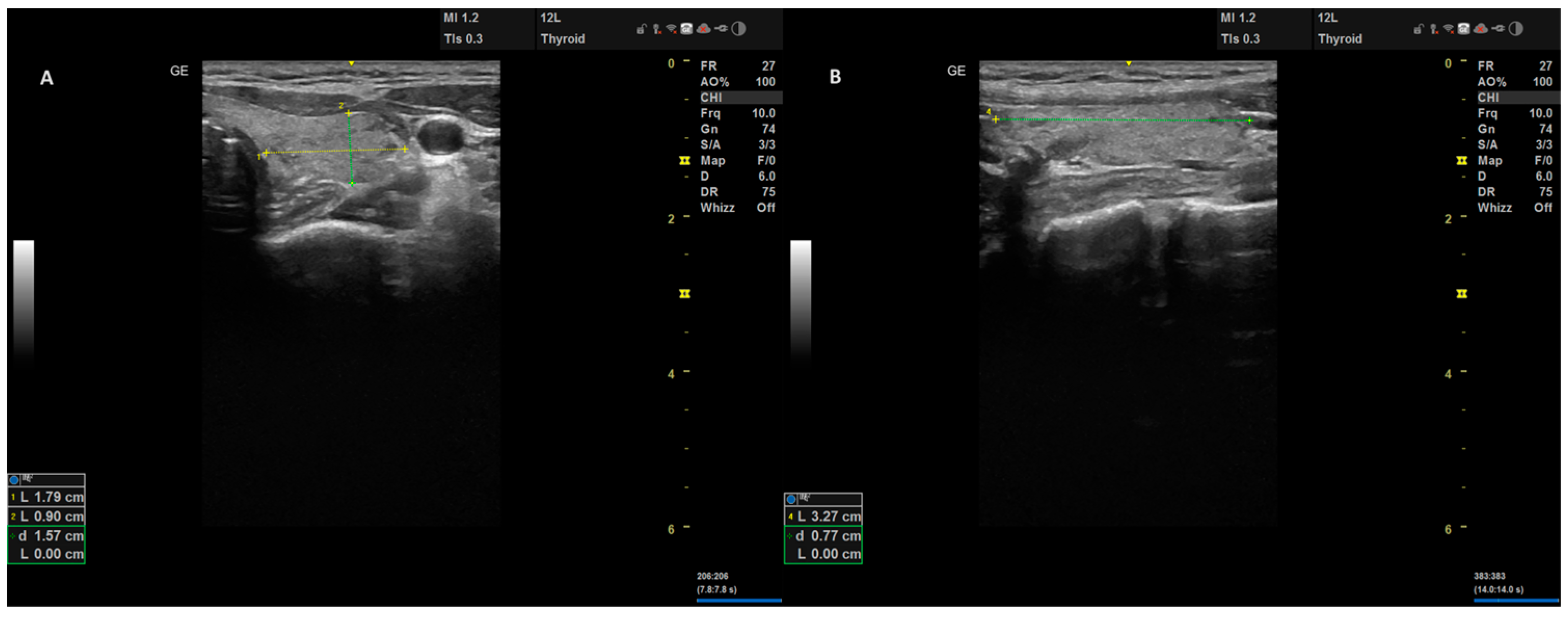 Jcm Free Full Text Unveiling The Accuracy Of Ultrasonographic