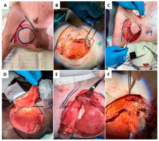 JCM | Free Full-Text | The Impact of Transfer-Related Ischemia on Free ...