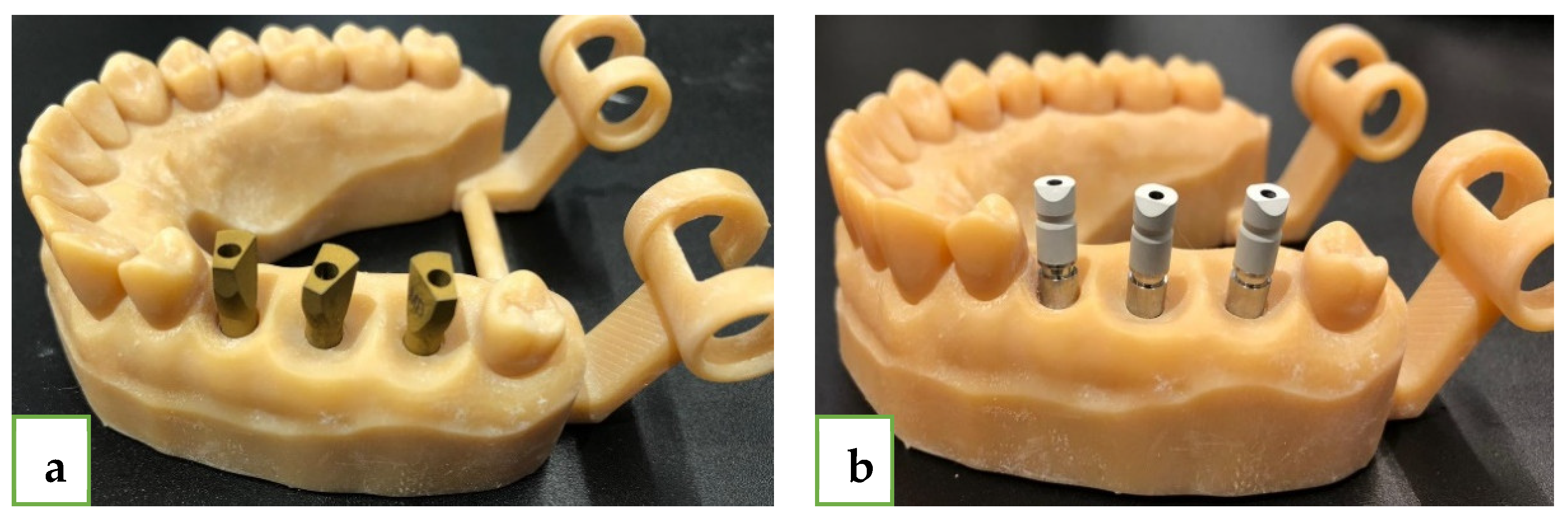 The Influence of Laboratory Scanner versus Intra-Oral Scanner on ...