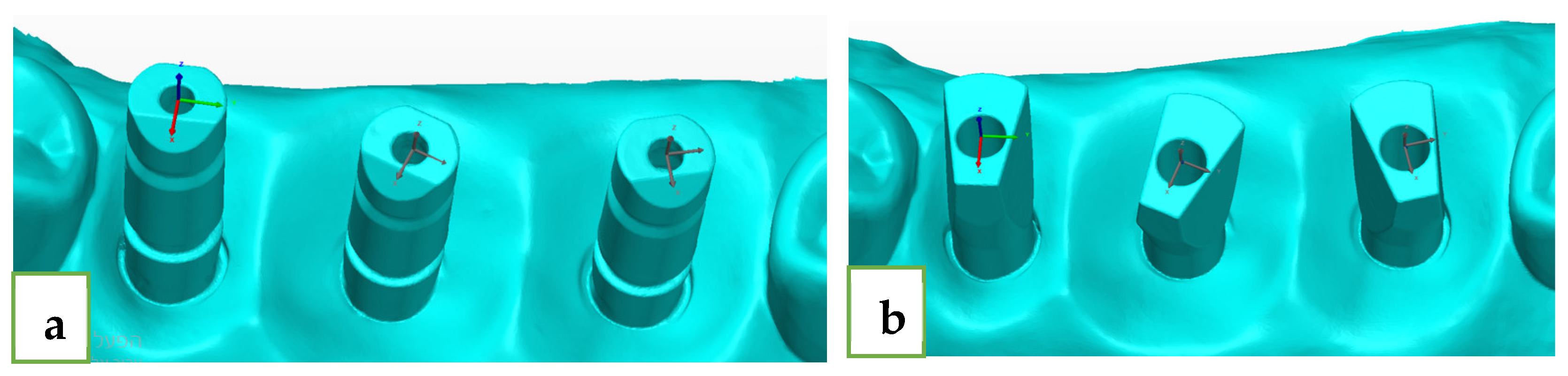 The Influence of Laboratory Scanner versus Intra-Oral Scanner on ...