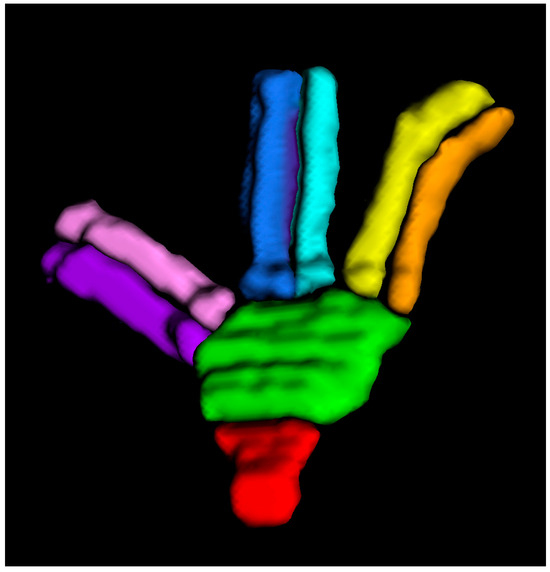 Quantitative Anatomical Comparison of Surgical Approaches to Meckel’s Cave