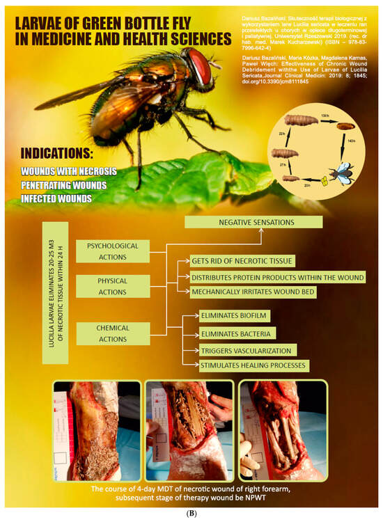 Larval Wound Therapy: Possibilities and Potential Limitations—A ...