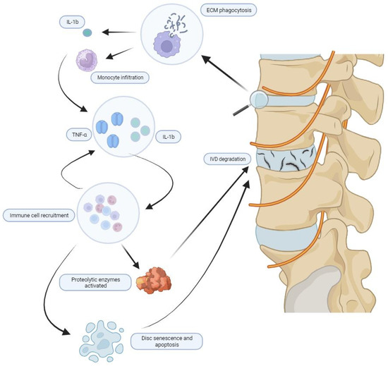Updates on Pathophysiology of Discogenic Back Pain