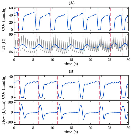 The Role of Chest Compressions on Ventilation during Advanced ...