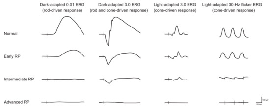 Application of Electrophysiology in Non-Macular Inherited Retinal ...