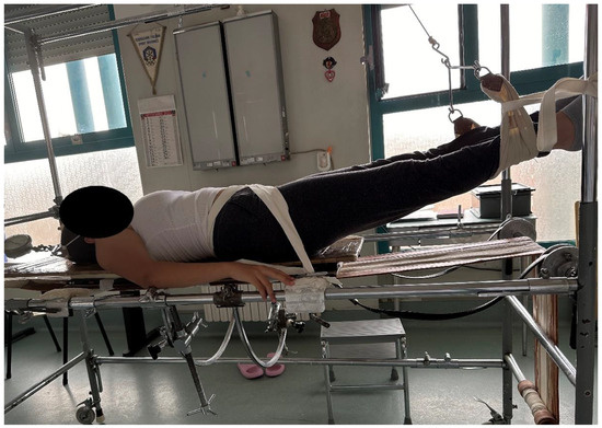 What Is the Role of Traction Test Radiographs in the Preoperative ...