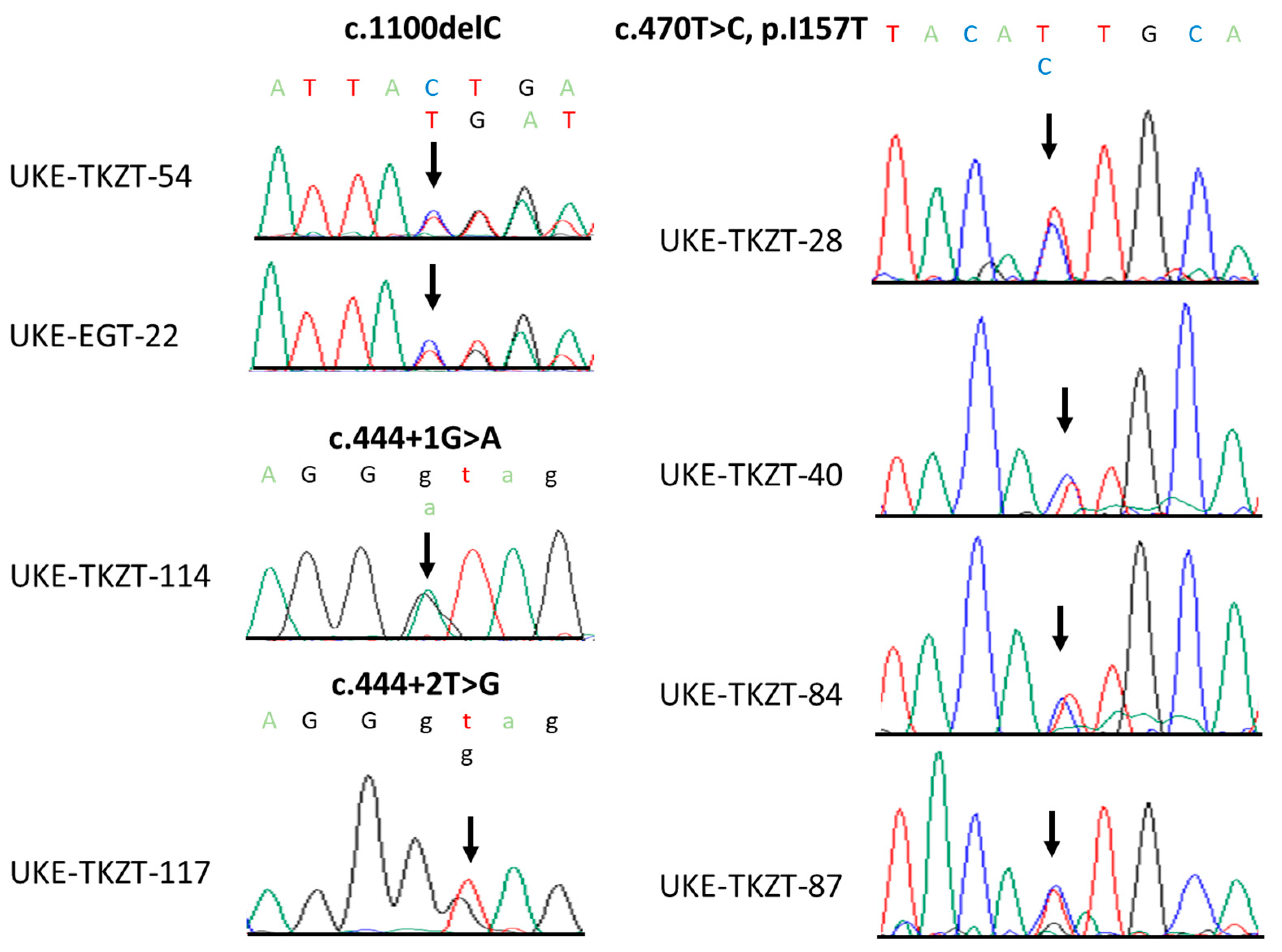 Jcm Free Full Text Further Association Of Germline Chek2 Loss Of