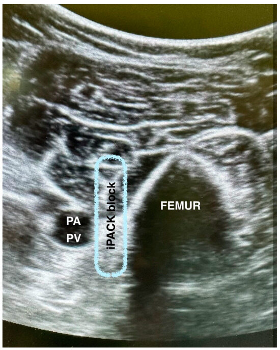 JCM | Free Full-Text | Pain Management, Functional Recovery, and Stress ...