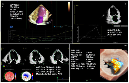 Contemporary Echocardiographic Evaluation of Mitral Regurgitation and ...