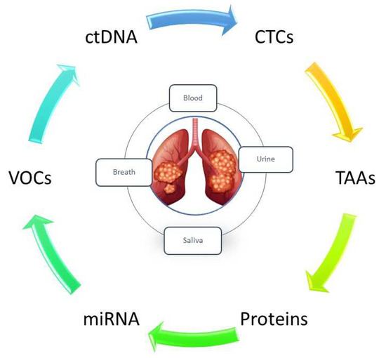 JCM | Free Full-Text | The Early Diagnosis of Lung Cancer: Critical ...