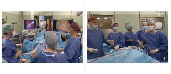 Simultaneous Bilateral Video–Endoscopic Inguinal Lymphadenectomy for ...