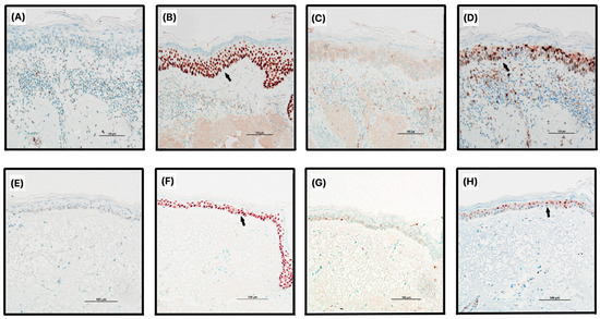 Expression of p53, p63, p16, Ki67, Cyclin D, Bcl-2, and CD31 Markers in ...