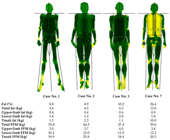 Clinical Characterisation and Comorbidities of Acquired Generalised ...