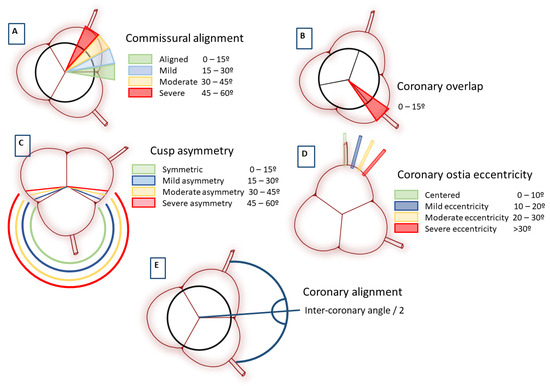 The Incidence, Impact, and Techniques of Commissural Alignment in ...