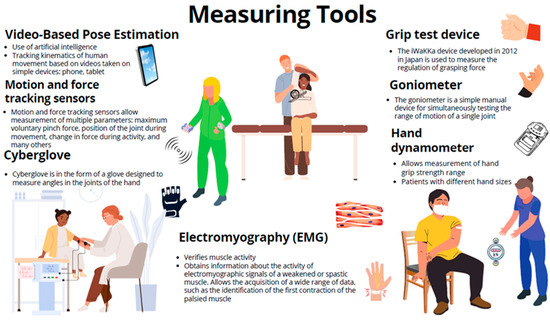 JCM | Free Full-Text | Objectivizing Measures of Post-Stroke Hand ...