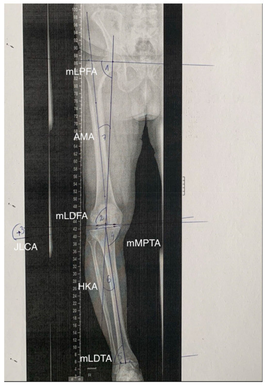 JCM | Free Full-Text | Enhancing Precision and Efficiency in Knee ...