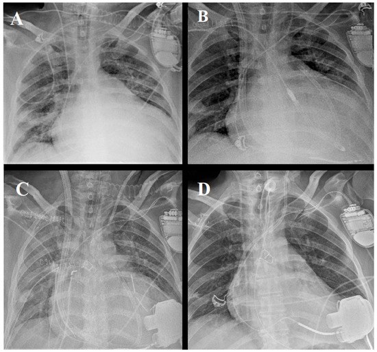 JCM | Free Full-Text | Test Bench for Right Ventricular Failure ...