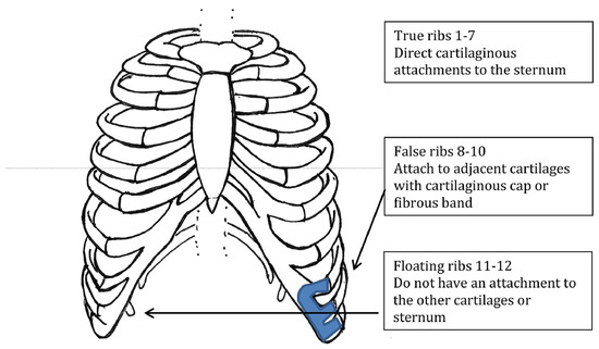 A Review of Slipping Rib Syndrome: Diagnostic and Treatment Updates to ...