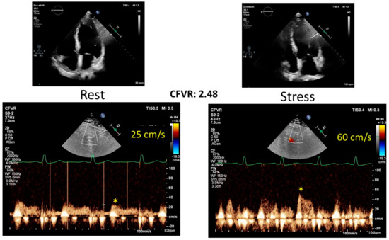 Exercise Stress Echocardiography in Athletes: Applications, Methodology ...