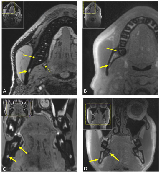 Imaging in Third Molar Surgery: A Clinical Update