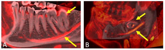 Imaging in Third Molar Surgery: A Clinical Update