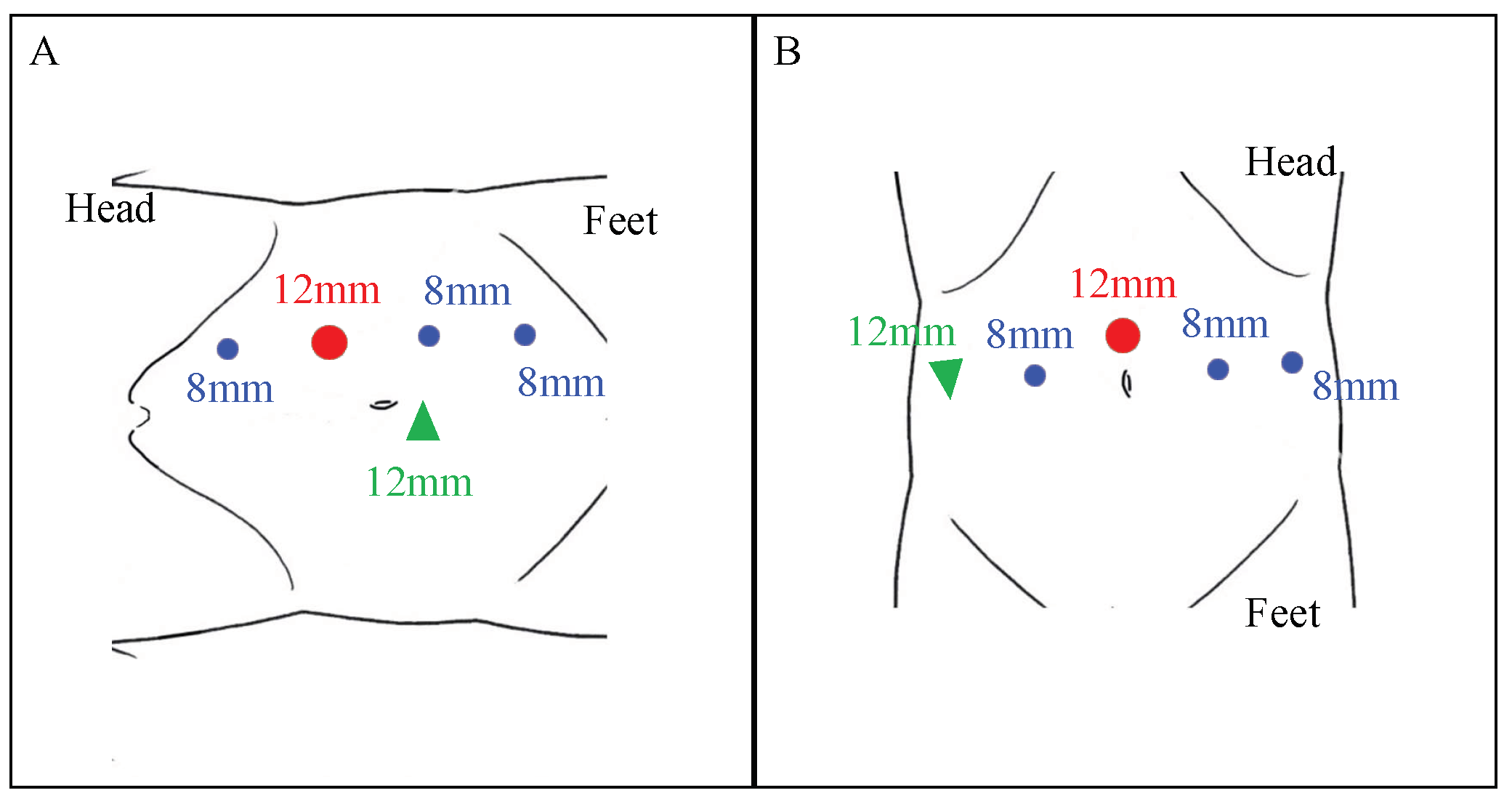 Jcm Free Full Text Efficacy Of Robot Assisted Ureteroureterostomy