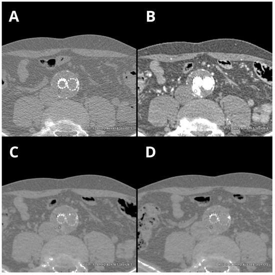 JCM | Free Full-Text | Review of Clinical Applications of Dual-Energy ...