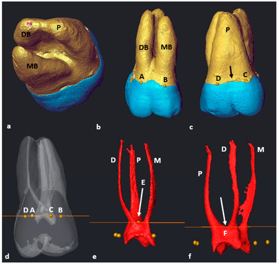 A New Methodology to Determine the Orifice for Root Canal ...