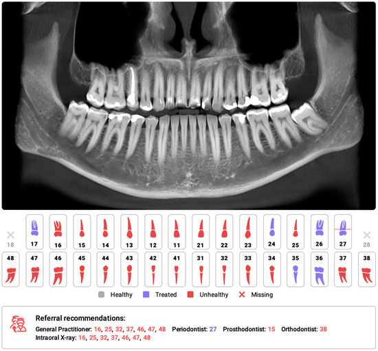 AI in Orthodontics: Revolutionizing Diagnostics and Treatment Planning ...