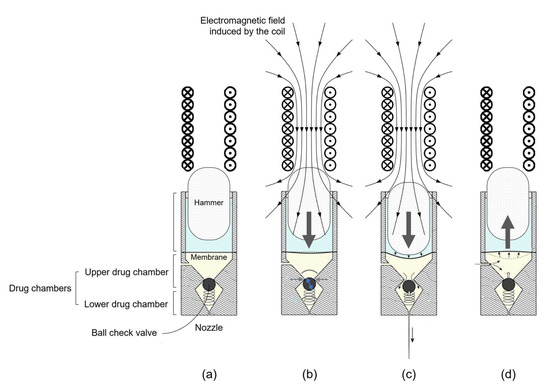 Needle-Free Jet Injection of Poly-(Lactic Acid) for Atrophic Acne Scars ...