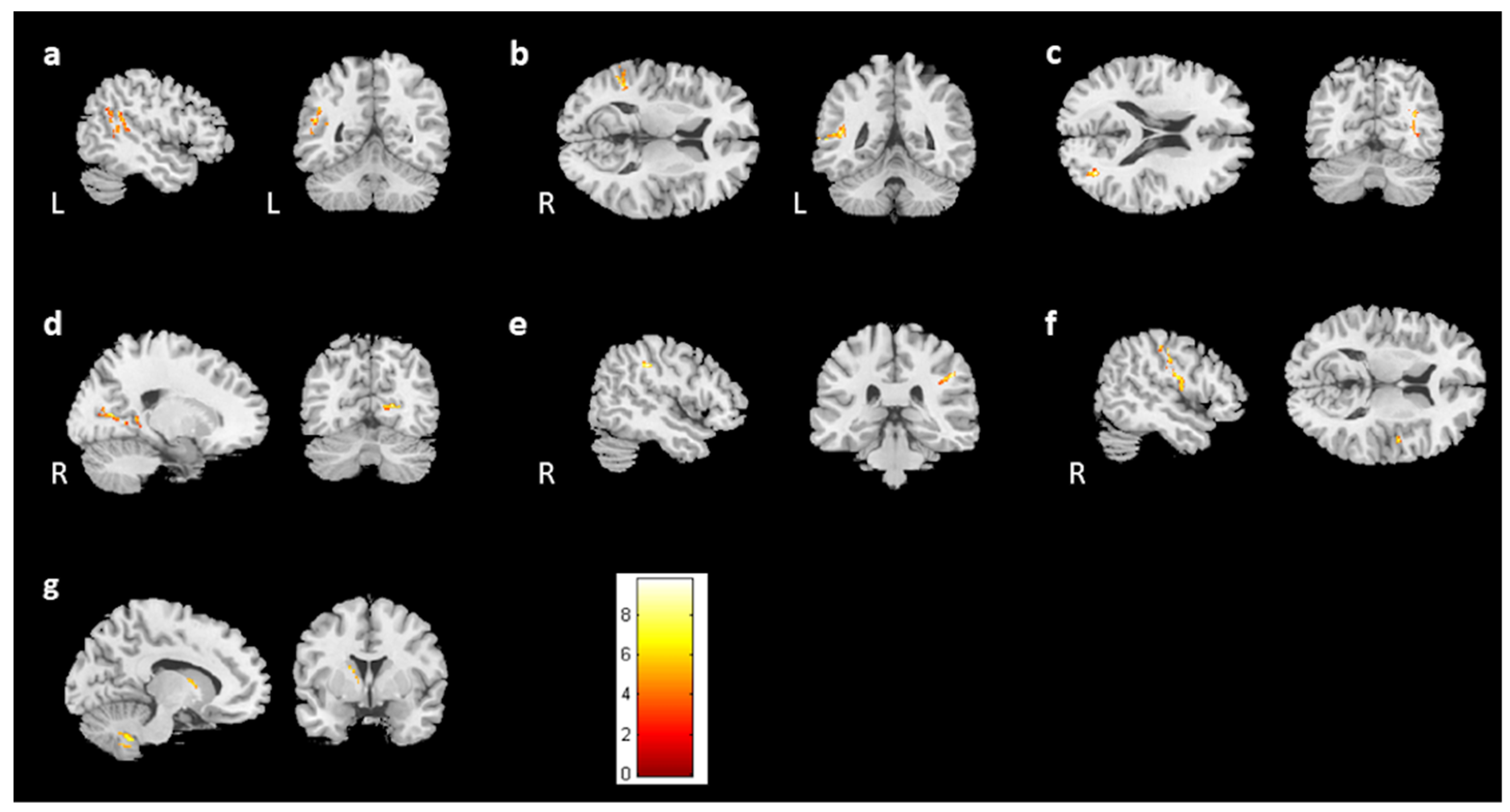 Association of Longitudinal Changes in Cerebral Microstructure with Cognitive Functioning in ...