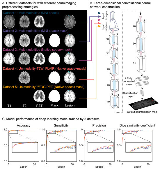 Deep Learning Approaches for Imaging-Based Automated Segmentation of Tuberous Sclerosis Complex