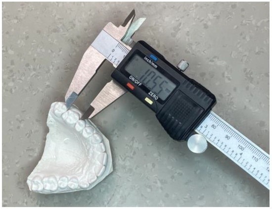 Comparison of Tooth Size Measurements in Orthodontics Using ...