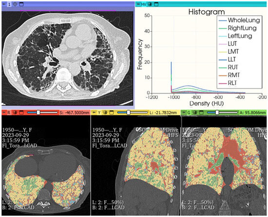 The Unveiled Triad: Clinical, Radiological and Pathological Insights ...