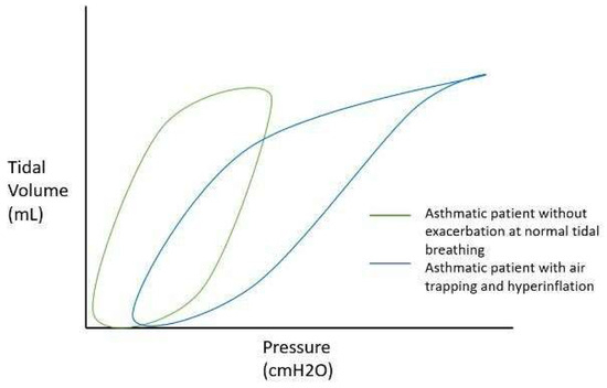 Critical Care Management of Severe Asthma Exacerbations