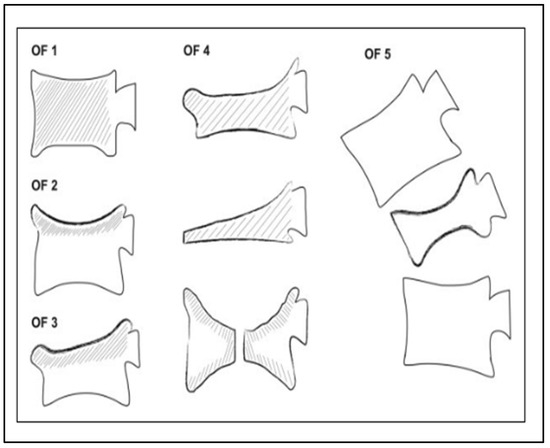 JCM | Free Full-Text | Multidisciplinary and Coordinated Management of ...