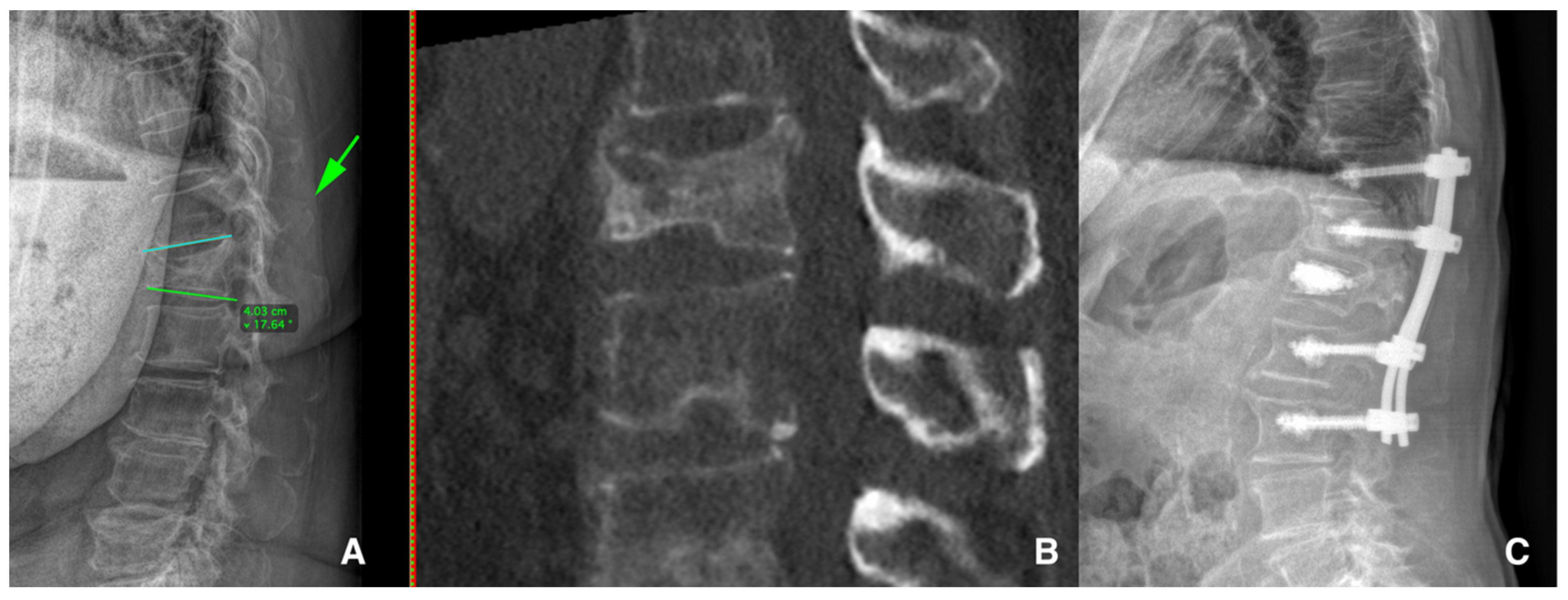 Jcm Free Full Text Multidisciplinary And Coordinated Management Of