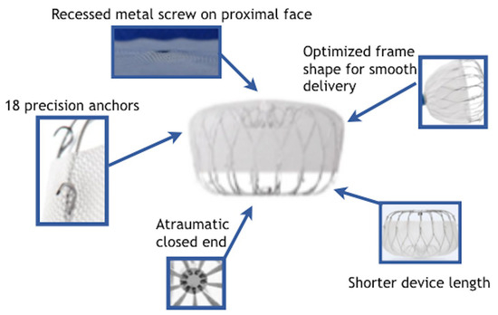 State-of-the-Art of Transcatheter Left Atrial Appendage Occlusion