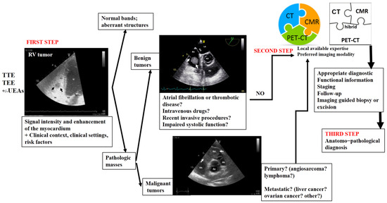 Multimodality Imaging in Right Heart Tumors: Proposed Algorithm towards ...