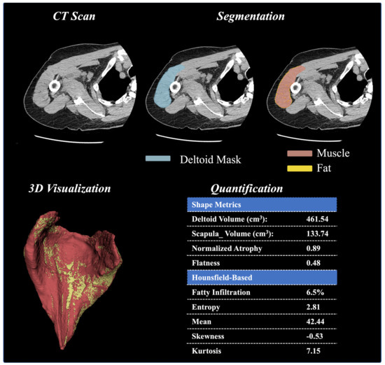 JCM | Free Full-Text | Impact of Deltoid Computer Tomography Image Data ...