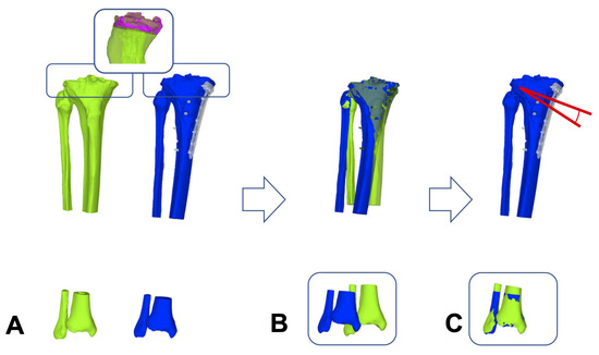 Validation of a Three-Dimensional Weight-Bearing Measurement Protocol ...