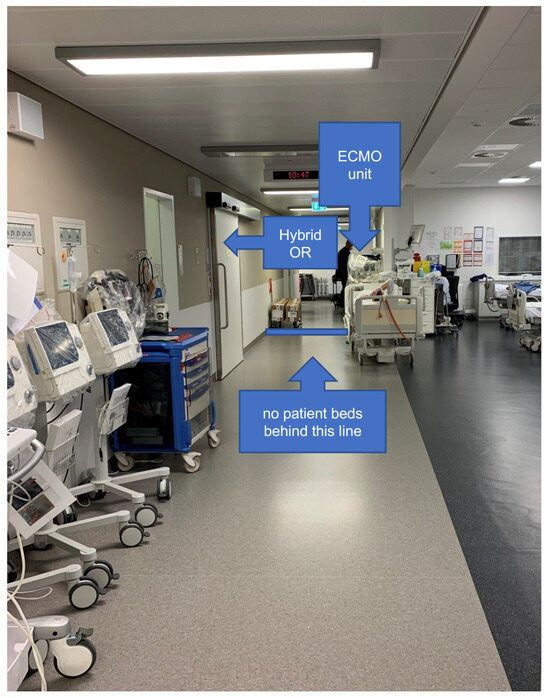 The Jena Method: Perfusionist Independent, Standby Wet-Primed ...