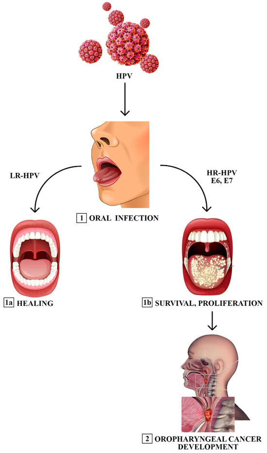 Analogies between HPV Behavior in Oral and Vaginal Cavity: Narrative ...