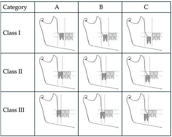 Radiographic Detection Rate of Distal Surface Caries in the Mandibular ...